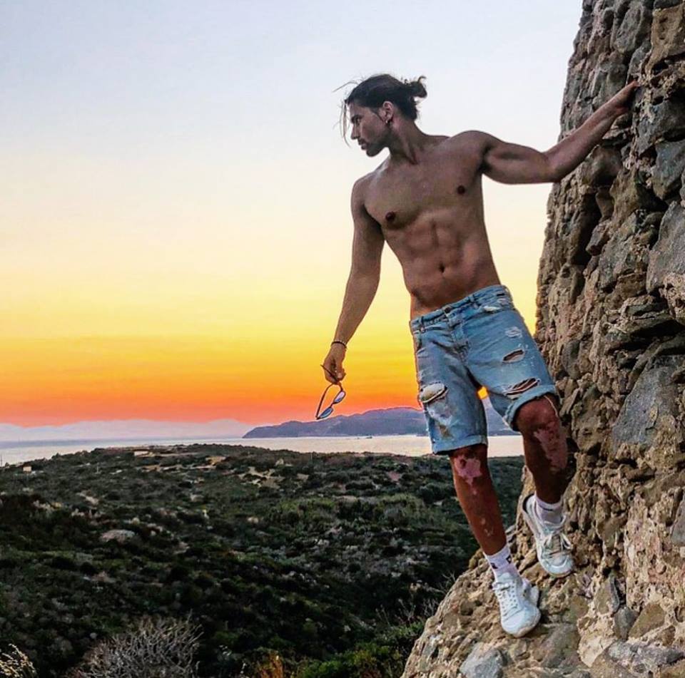 What does Luca Onestini have on his legs